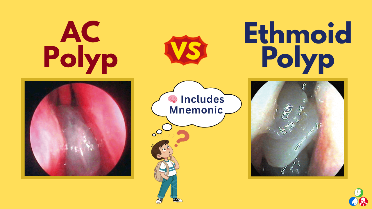 Antrochoanal Polyp vs Ethmoidal Polyp | ENT Notes & Lectures
