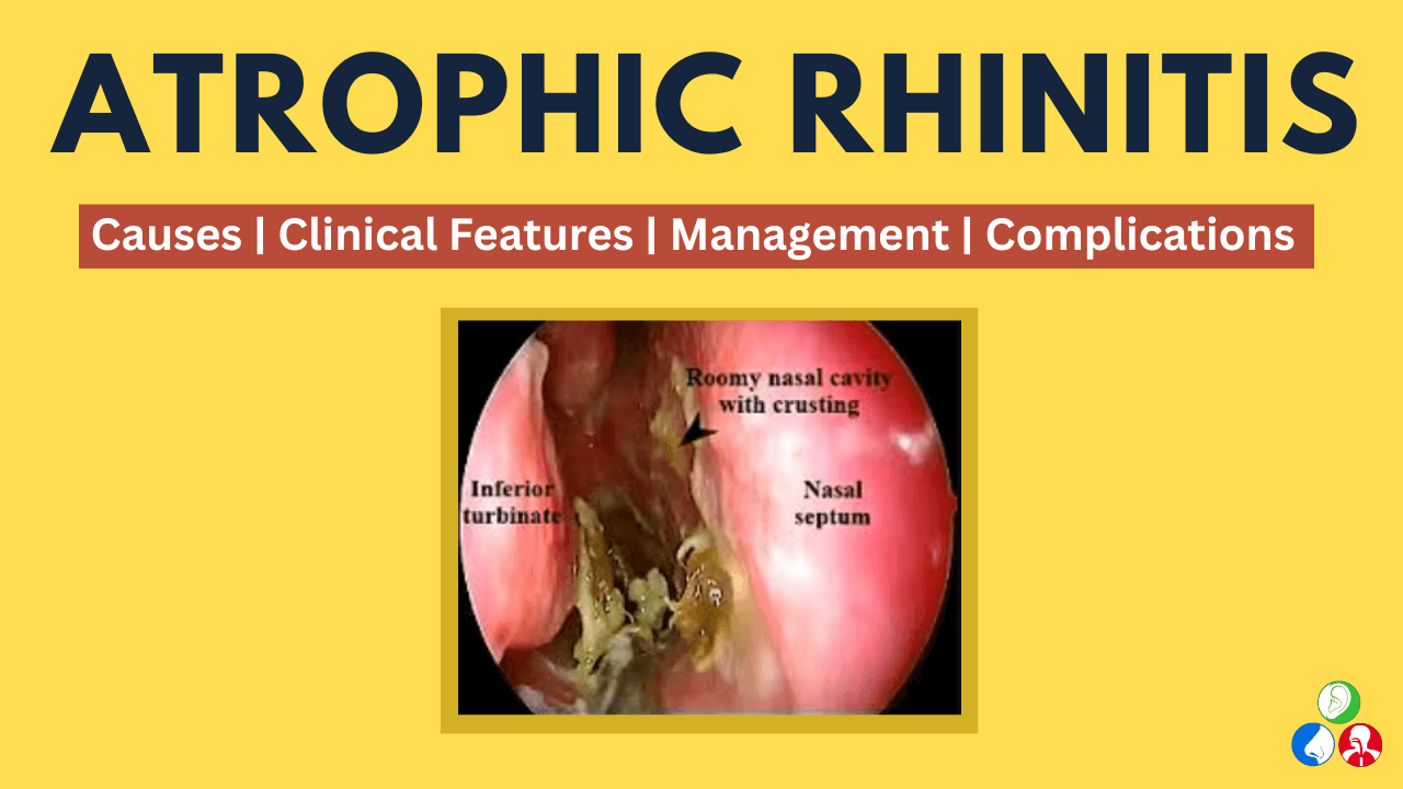 Atrophic Rhinitis | ENT Notes & Lectures