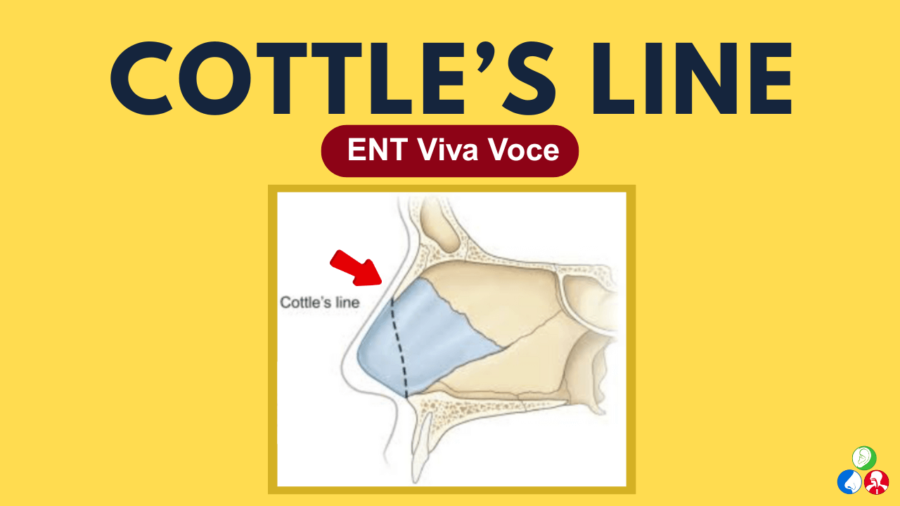 Cottle’s Line | ENT Notes & Lectures