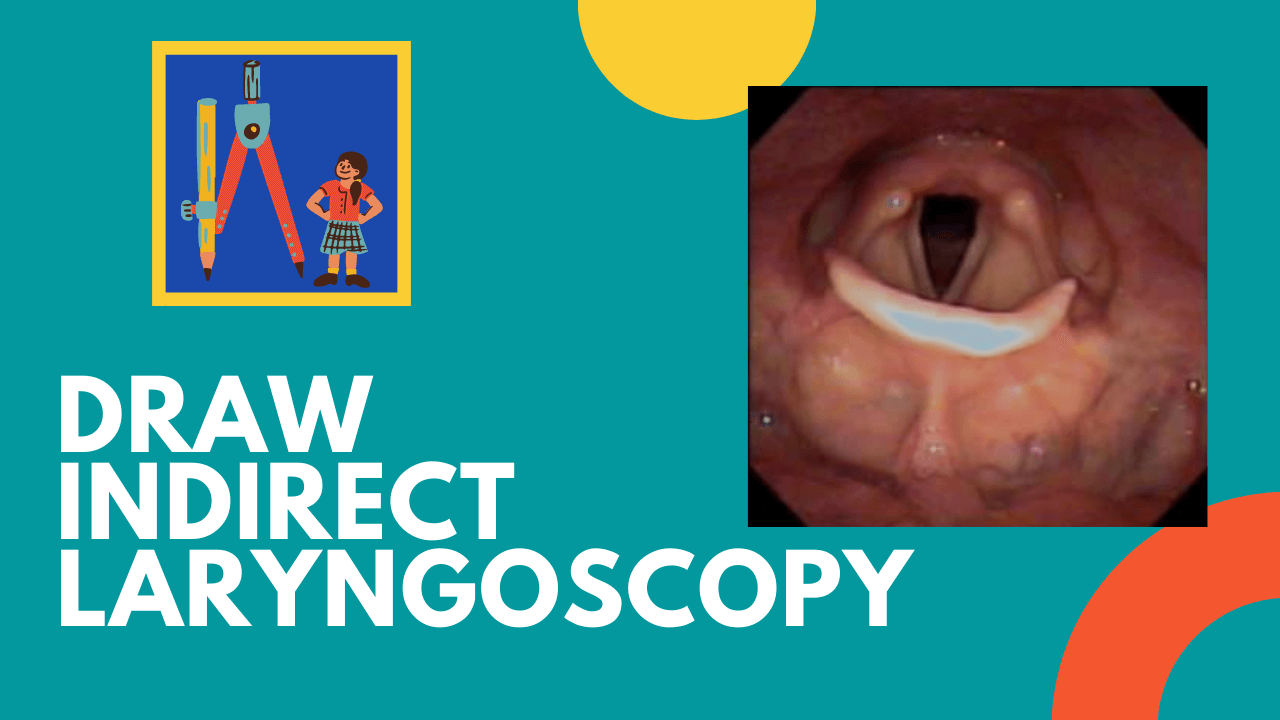 Indirect Laryngoscopy Diagram - How to Draw and Label | ENT Notes ...