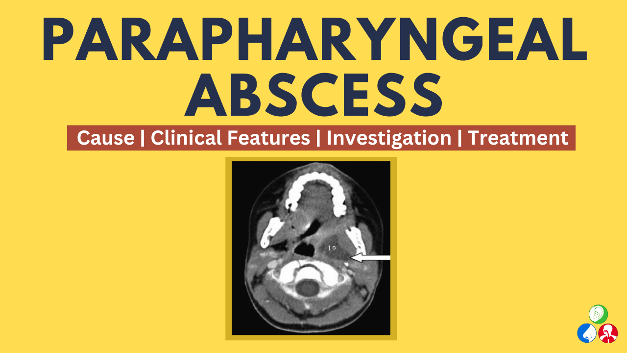 Parapharyngeal Abscess | ENT Notes & Lectures