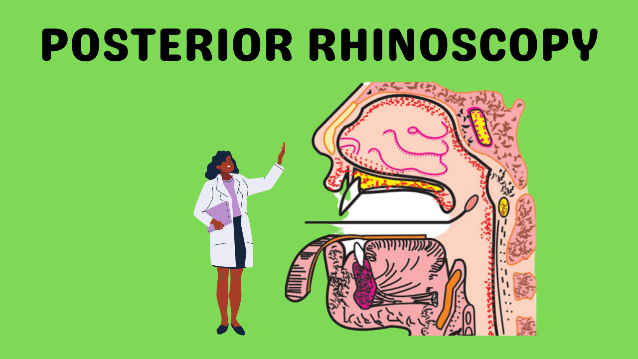 Posterior Rhinoscopy | ENT Notes & Lectures