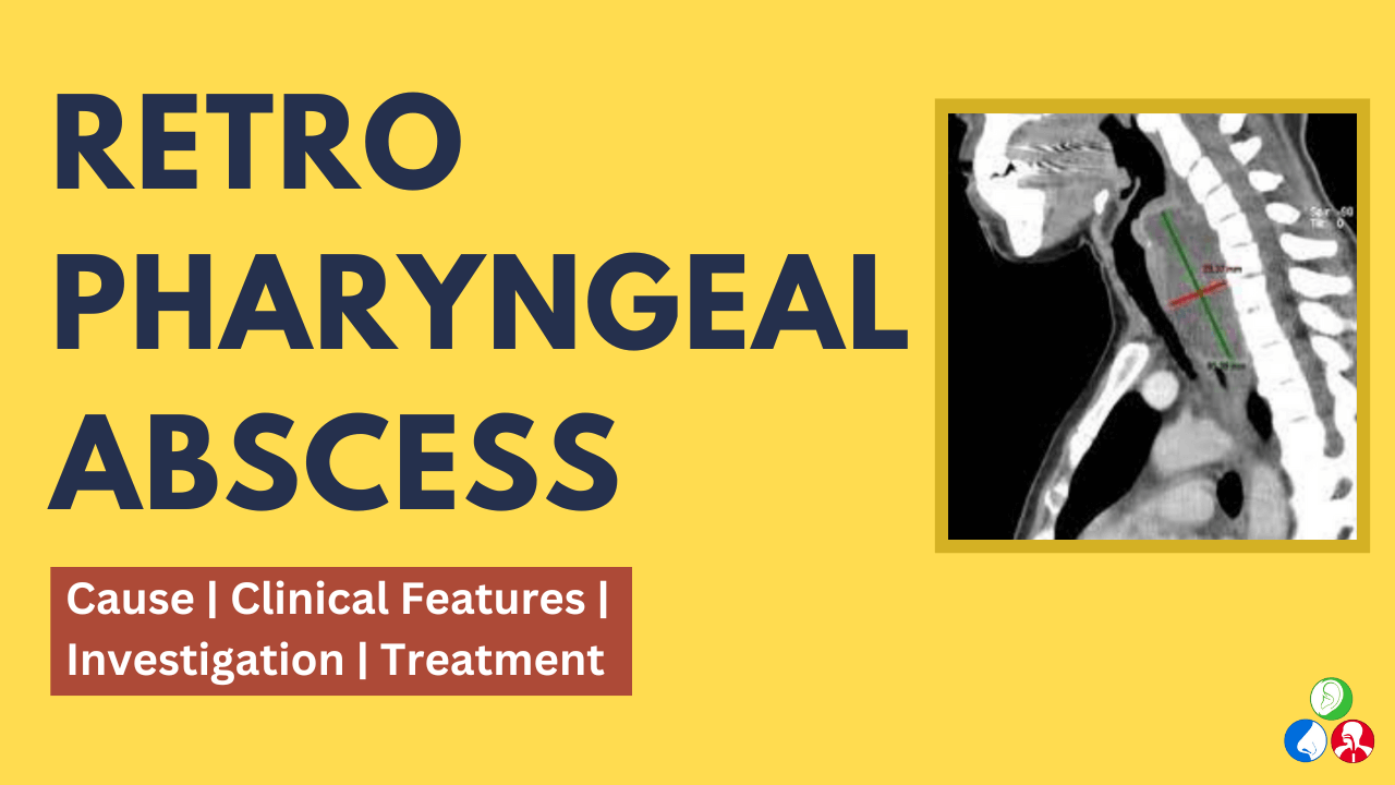 Retropharyngeal Abscess | ENT Notes & Lectures