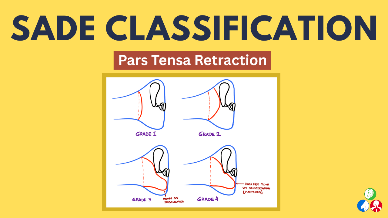 Sade Classification - Pars Tensa Retraction | ENT Notes & Lectures